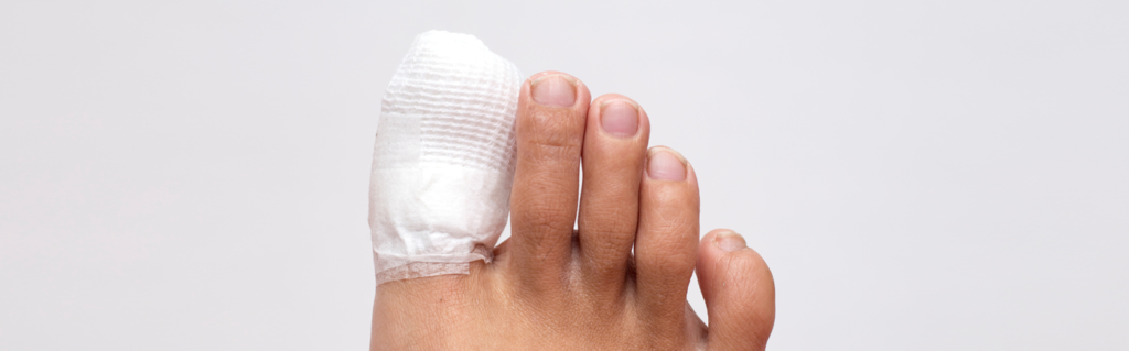 Finger and Toenail surgery - Singleton MC